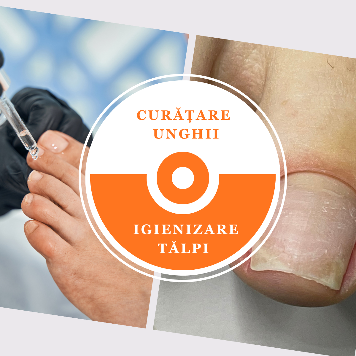 Pedichiură Medicală București | Podolog Sector 2 | 50 RON - podo.express