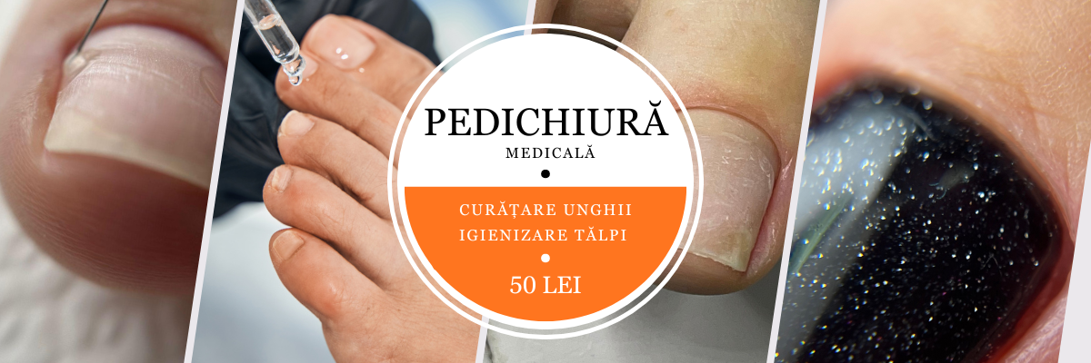 Pedichiură Medicală București | Podolog Sector 2 | 50 RON - podo.express